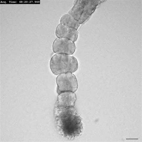 ヒト体節の形成過程、ips細胞で再現に成功 京都大学研究グループ発表 47news（よんななニュース）：47都道府県52参加新聞社と共同通信の