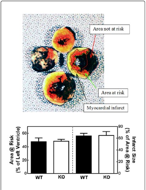 Area At Risk And Myocardial Infarct Size Following 30 Min Myocardial