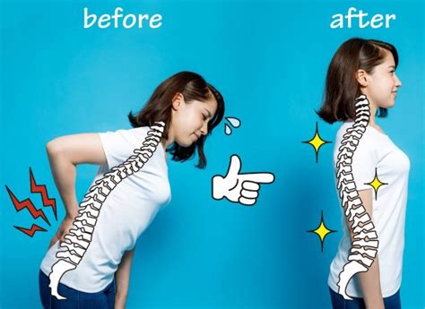 5 Easy Techniques To Improve Your Posture
