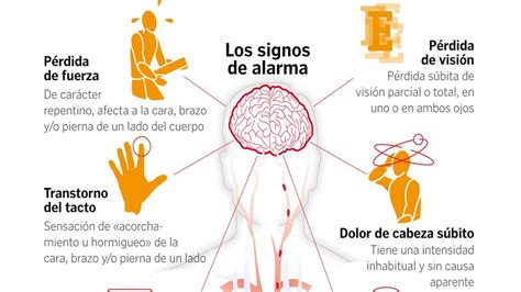 Terapia Celular Y Enfriamiento Del Cerebro El Futuro Para Tratar El Ictus