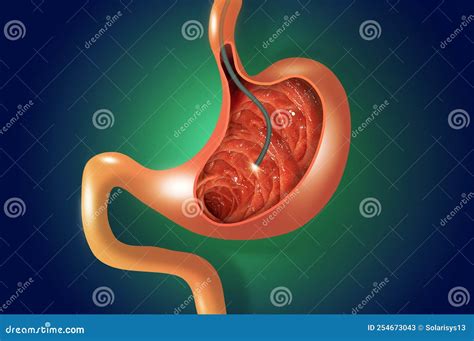 Digestive Endoscopy Or Gastroscopy Performing A Gastroscopy Procedure