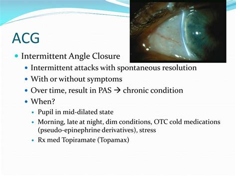 Ppt Diagnosis And Management Of Angle Closure Glaucoma Powerpoint