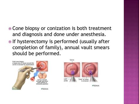 Ppt Premalignant Conditions Of The Cervix Powerpoint Presentation