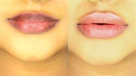 How To Make Lips Lighter Without Makeup Saubhaya Makeup
