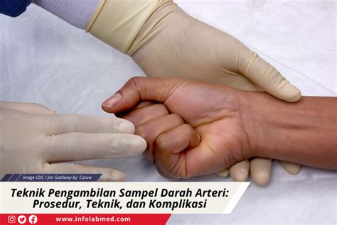 Teknik Pengambilan Sampel Darah Arteri Prosedur Teknik Dan Komplikasi