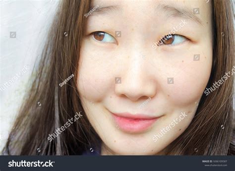 35件の「ほくろ 図解」の画像、写真素材、ベクター画像 Shutterstock