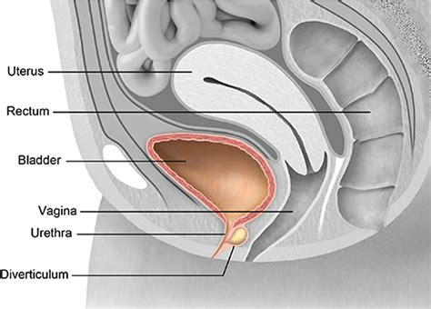 Urethral Diverticulum Definition Causes Symptoms Diagnosis And Treatment