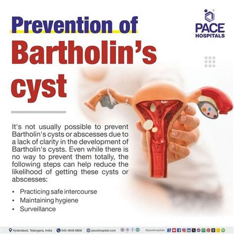Bartholins Cyst Popping
