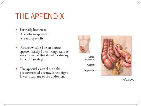 ppt appendicitis powerpoint presentation free download id 2176545