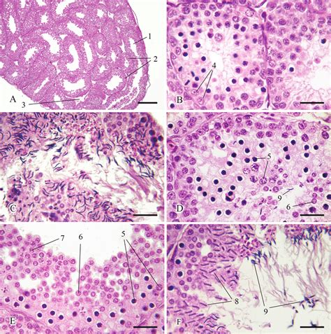 Histological Sections Of Testes Of A Kitaibelii Stained With Harris