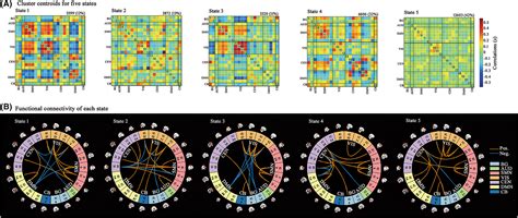 Altered Dynamic Functional Network Connectivity In Levodopa‐induced