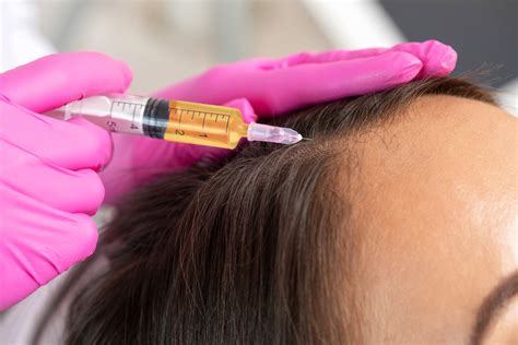 Stem Cell Therapy For Hair