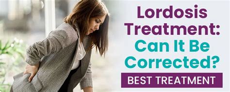 Lordosis Treatment Before After