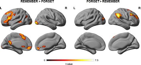 Whole Brain Statistical Parametric Maps Representing Brain Activation