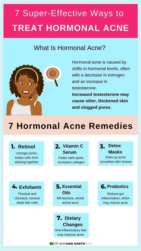 How To Treat Hormonal Acne Naturally 8 Treatments Artofit