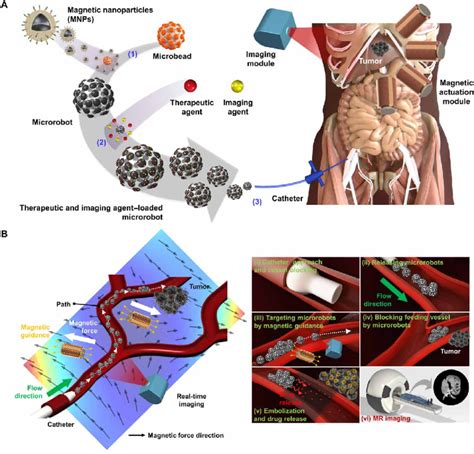 Schematic Of Targeted Vessel Embolization And Drug Delivery Using The