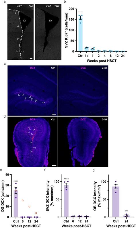 Effect Of Hsct On Svz Proliferation Adult Neurogenesis Neural