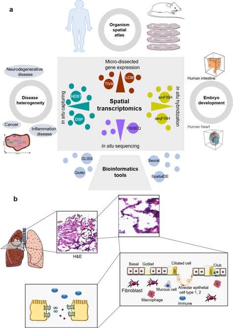 Clinical And Translational Values Of Spatial Transcriptomics Signal