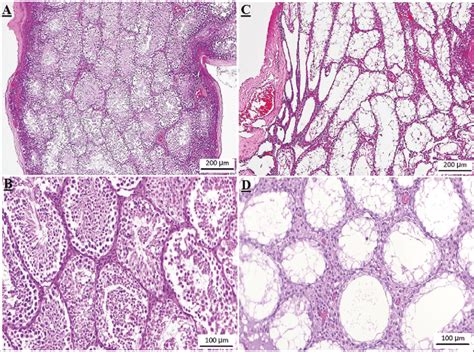 Hematoxylin And Eosin Stained Sections Of Testis A And B Control