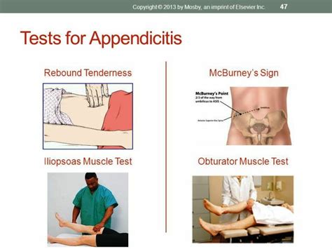 appendicitis test