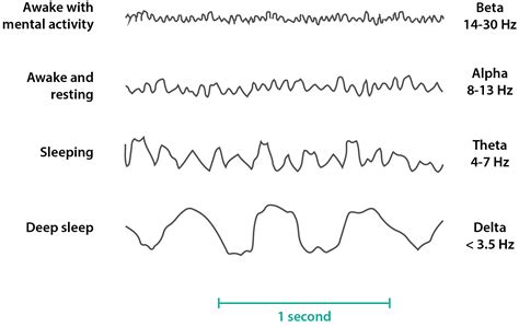 the wave the characteristics of an eeg — firstclass
