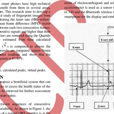 The Normal Ecg Waveform [1] Download Scientific Diagram