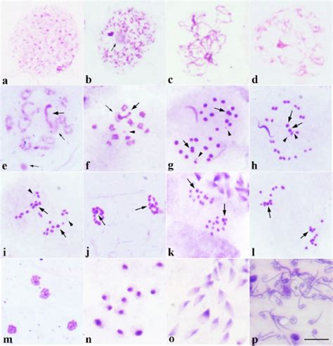 microscopy how do i identify the different stages of meiosis under