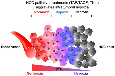 Cells Free Full Text Hypoxia Metabolic Reprogramming And Drug