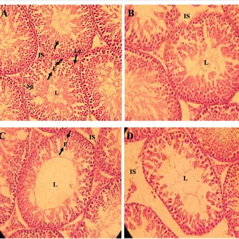 Photomicrograph From Testicular Tissue Showing A Control With A