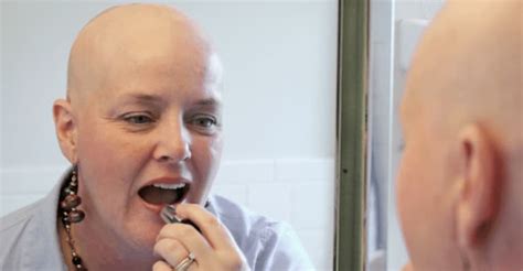 Hair Loss Treatment Clinicexpert