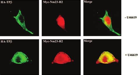 Immunofluorescence Microscopy Of Tp Co Localization With Nm23 H2 In