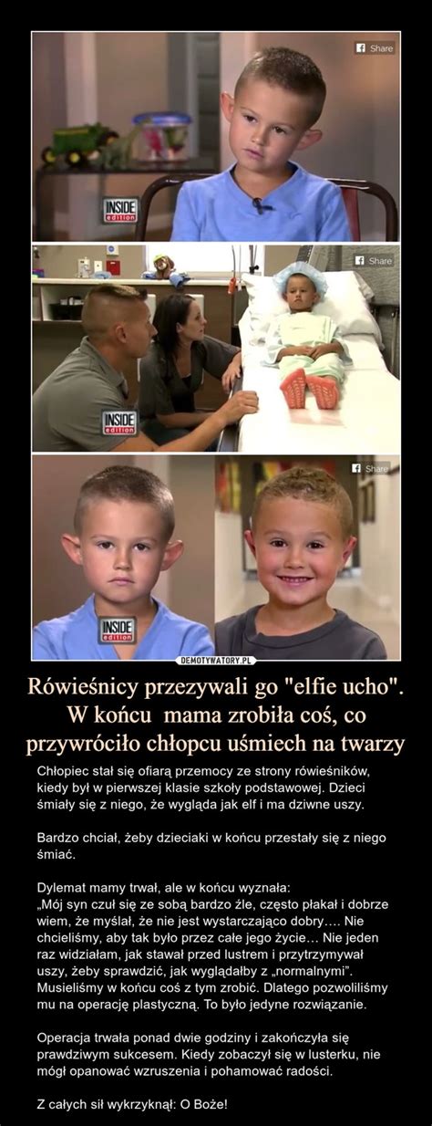 Rówieśnicy Przezywali Go Elfie Ucho W Końcu Mama Zrobiła Coś Co