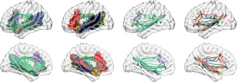 Mapping Language Networks Using The Structural And Dynamic Brain