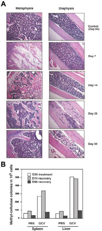 Analysis Of Bone Marrow Cellularity And Extramedullary Hematopoiesis
