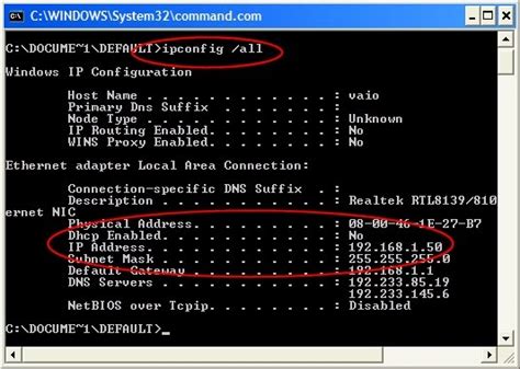 getting 169 ip address in vista