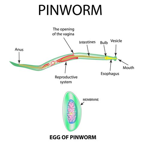 Enterobiasis Causes Symptoms Diagnosis And Treatment