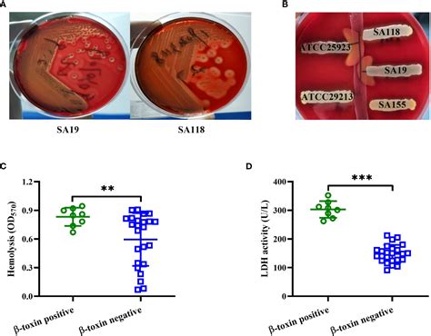 Frontiers New Insight Into The Virulence And Inflammatory Response Of