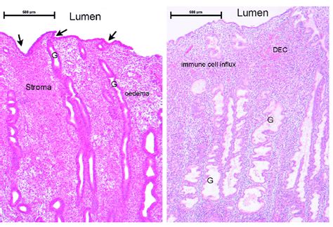 Uterus Histology Slides Labeled