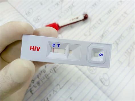 Mengenal Rapid Test Hiv Dan Efektivitasnya Alodokter