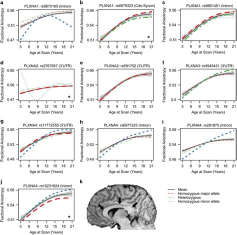 Plexin Mediated Developmental Trajectory Of The Corpus Callosum