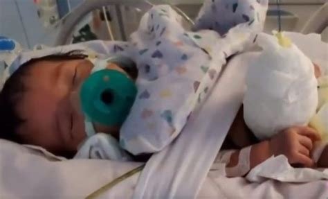 La Madre De La Bebé Que Nació Con órganos Expuestos Se Niega A Rendirse