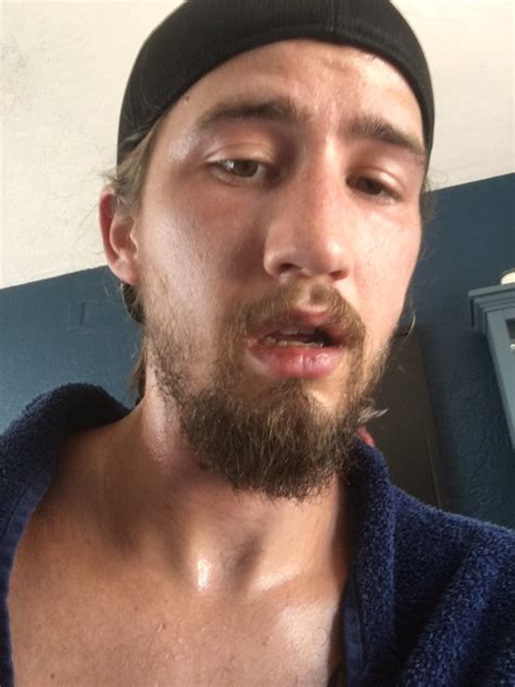 Moist Selfie