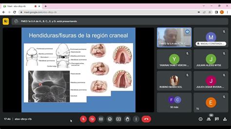 Embriología Sistema De Contención Neurosensorial Clase 8 Youtube