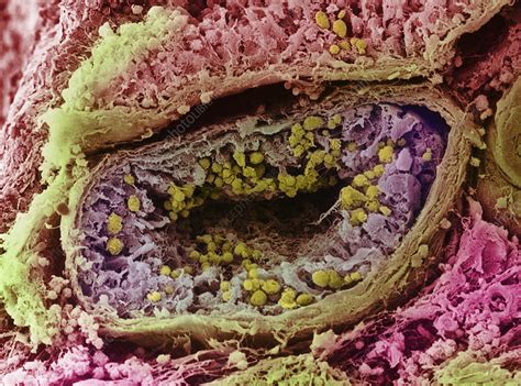 Seminiferous Tubule Of Testis Stock Image P608 0084 Science Photo