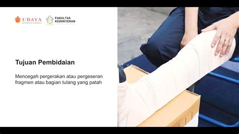Pertolongan Pertama Cara Yang Benar Untuk Pembidaiian Patah Tulang