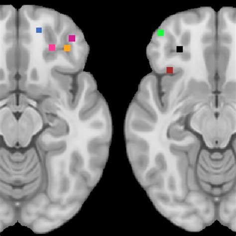 Orbitofrontal Cortex Ofc Clusters Demonstrating Preferential