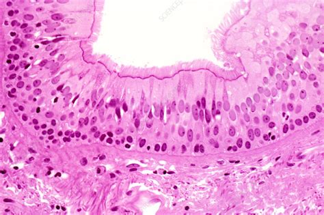 Pseudostratified