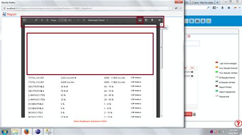 java how to customize the print button in itext pdf stack overflow