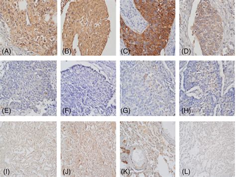 Expression Of Gasdermin E Gsdme Caspase‐3 Caspase‐8 And Caspase‐9