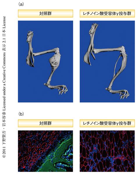 レチノイン酸受容体γに選択的なアゴニストによる異所性骨の形成の抑制とその分子機構 ライフサイエンス 新着論文レビュー